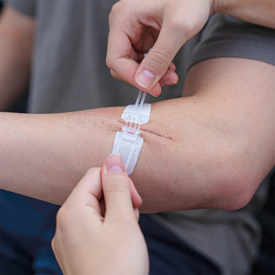 My Medic ZZIPS 2-Pack Wound Closure Kit - Battlbox.com